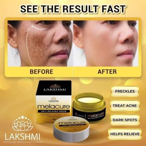 Lakshmi Melacure Anti-Melasma Cream 30g - Bcute-kw